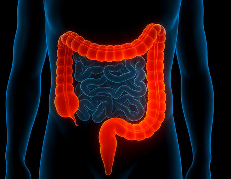 "Sigmoid Flexure" Imagens – Procure 702 fotos, vetores e vídeos | Adobe ...