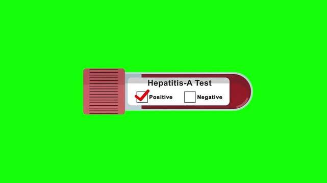 "Hepatitis A" Images – Browse 2,920 Stock Photos, Vectors, and Video ...
